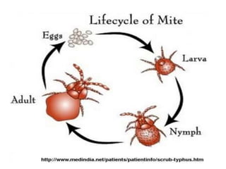 Tick and Lice.ppt