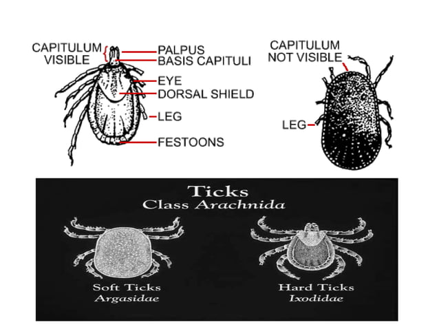 Tick and Lice.ppt | Infectious Diseases | Diseases and Conditions