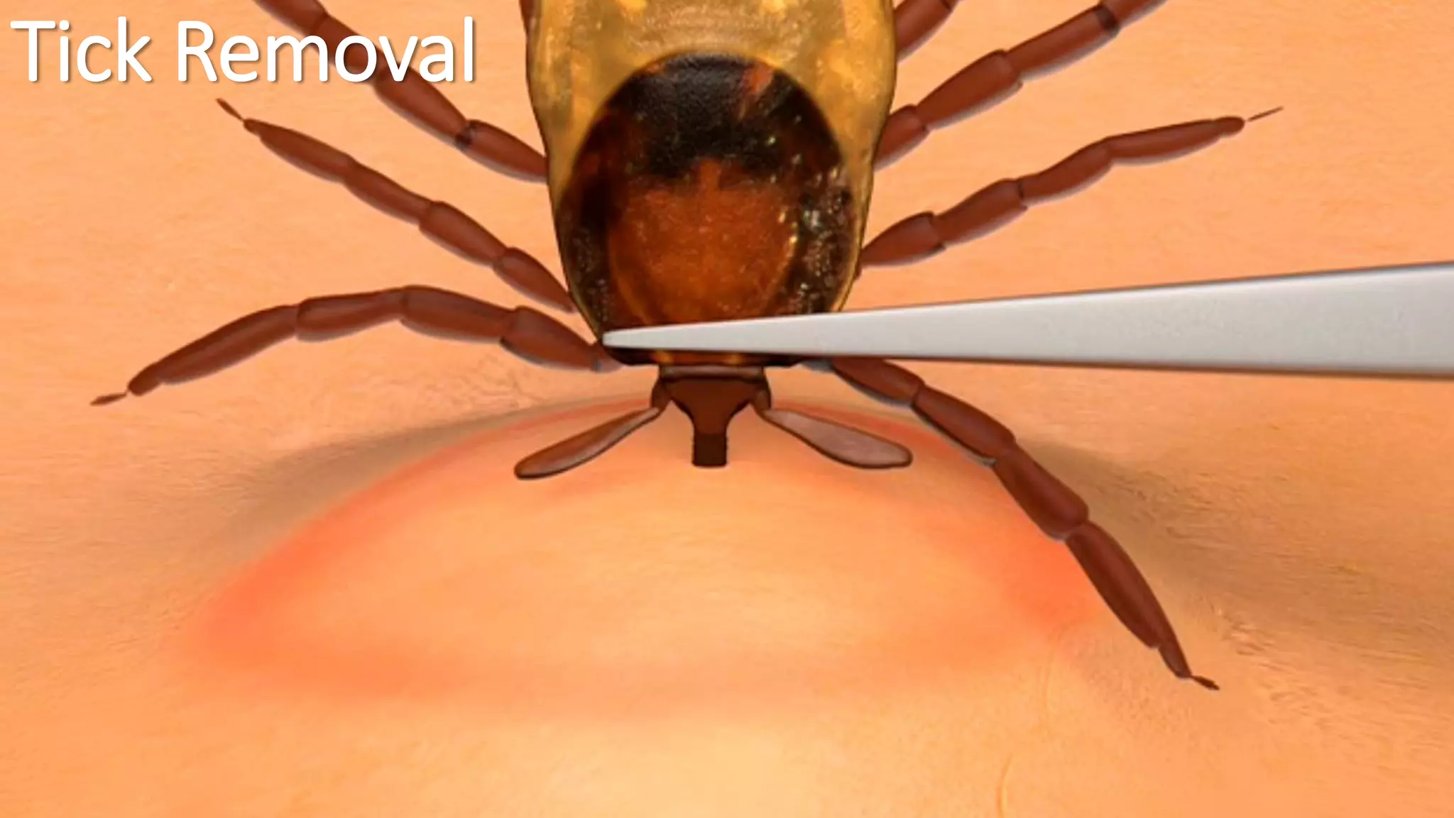 Safe presentation about ticks for Survival week. Draper University | PPTX