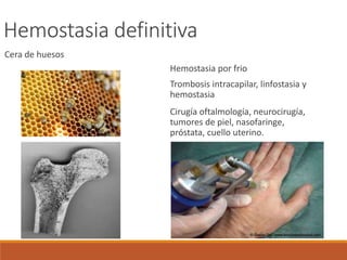 Tiempos quirúrgicos. Enfermería | PPTX
