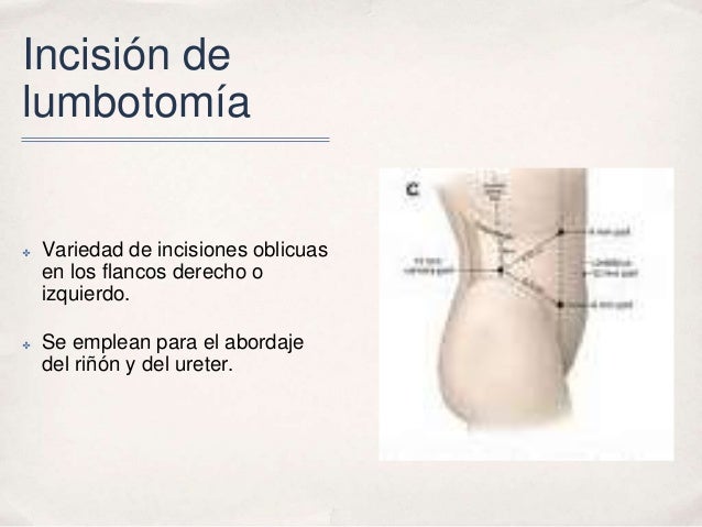 Tiempos quirúrgicos. Enfermería