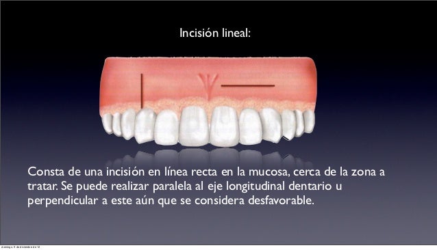 Tiempos Operatorios en Cirugía Bucal