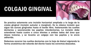 TIEMPOS OPERATORIOS EN CIRUGÍA BUCAL.pdf