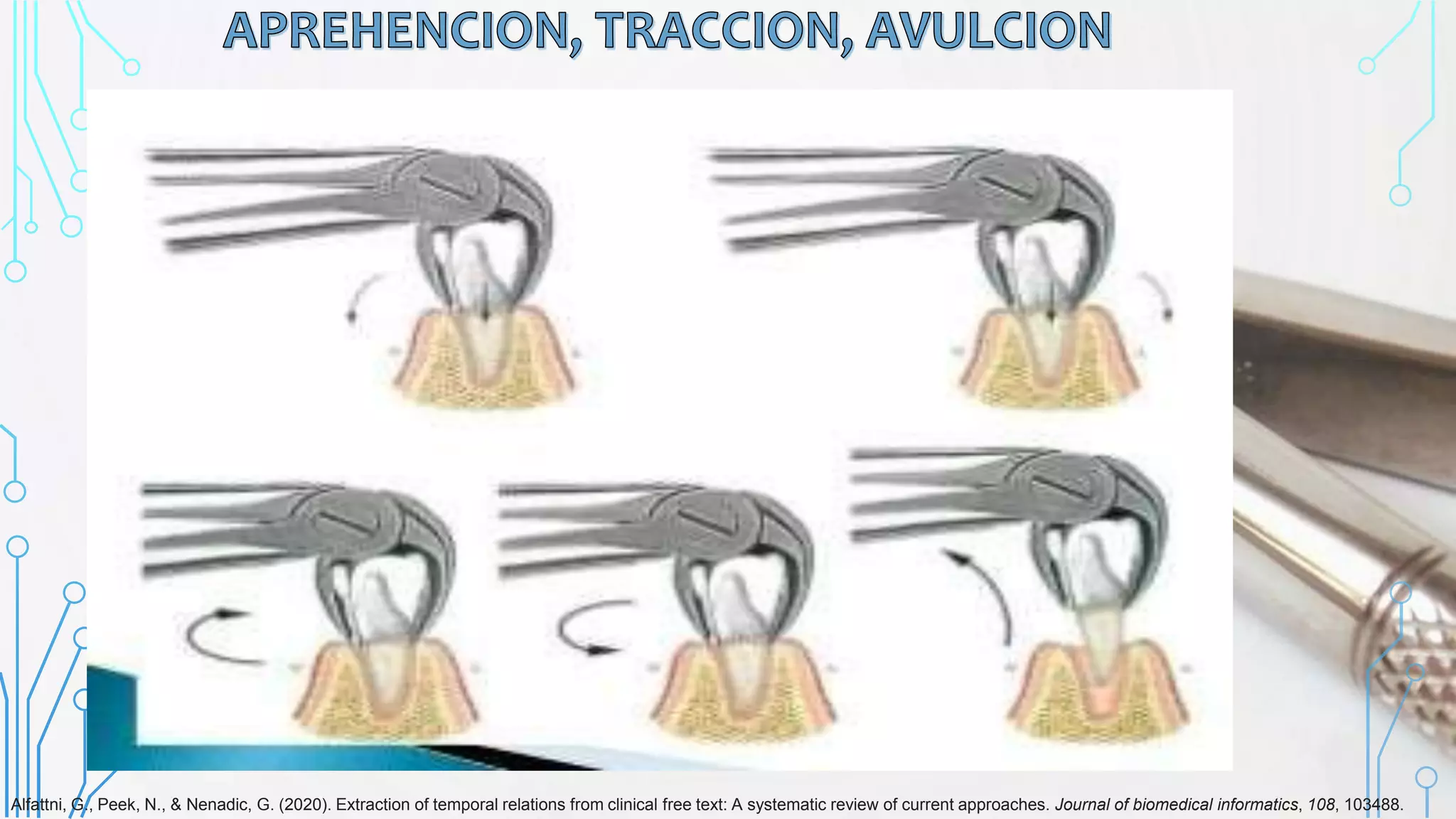TIEMPOS PARA UNA EXODONCIA.pptx