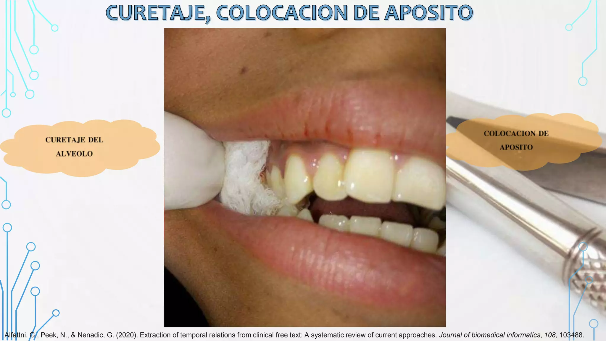 TIEMPOS PARA UNA EXODONCIA.pptx