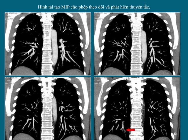 Tiem Thuoc Can Quang.pdf