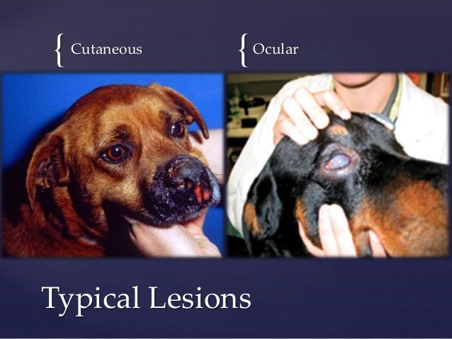 Blastomycosis Grand Rounds