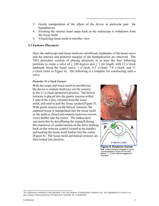 White paper on TIF with Esophyx | PDF
