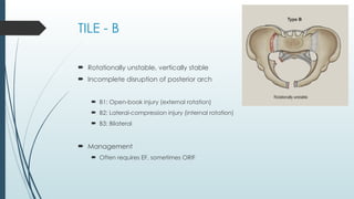Tile Classification of Pelvic Fractures.pptx