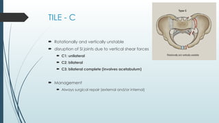 Tile Classification of Pelvic Fractures.pptx