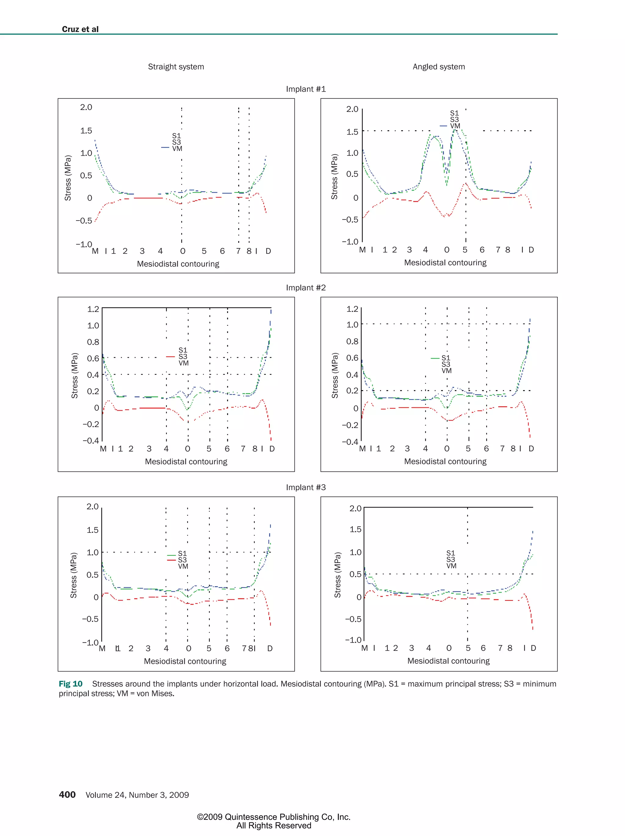 Tilted implants cruz-2009 | PDF