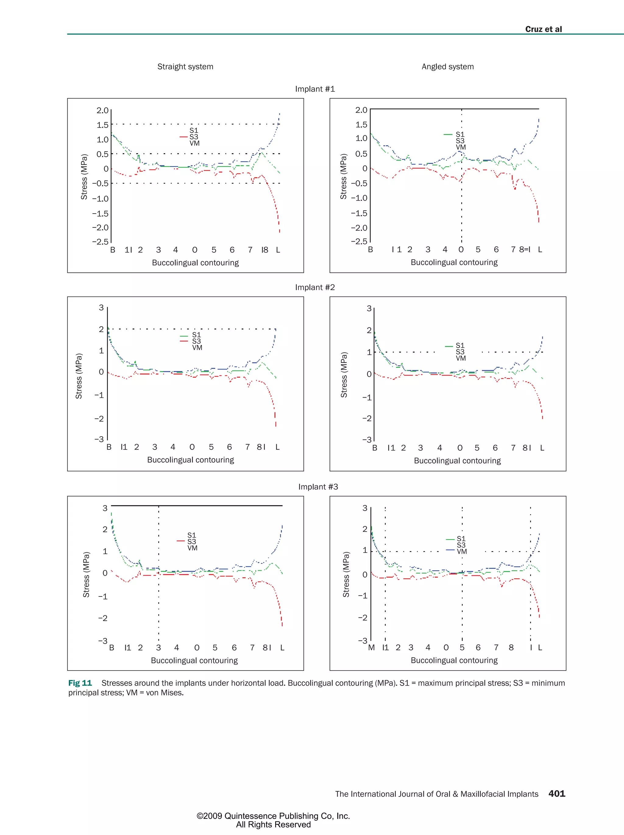 Tilted implants cruz-2009 | PDF