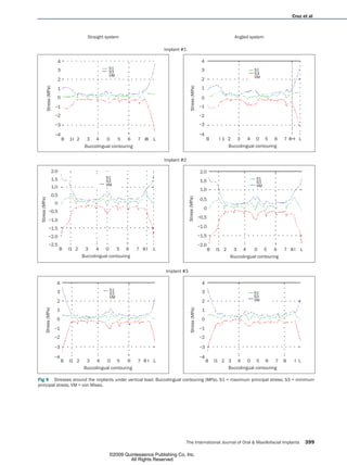 Tilted implants cruz-2009 | PDF
