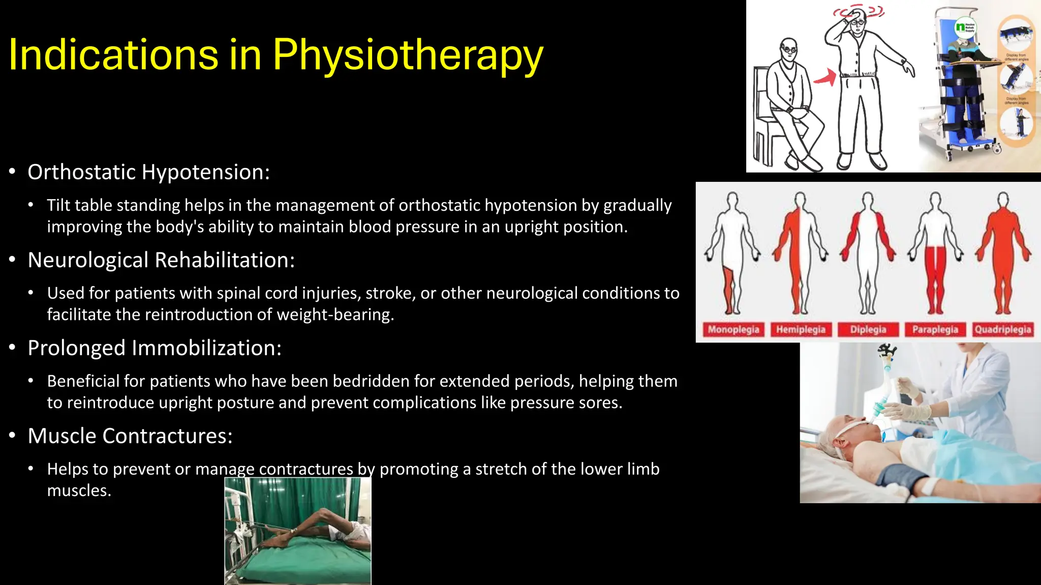 Tilt Table Standing in Physiotherapy.pdf