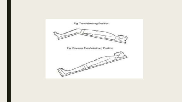 TILT TABLE TEST PRESENTATION.pptx | Heart and Cardiovascular Diseases ...