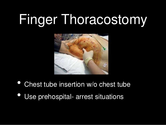 Time Critical Procedures Part 2