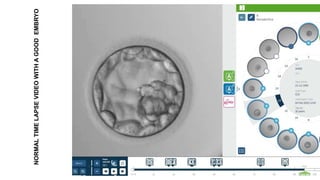Time lapse embryo monitoring | PPTX
