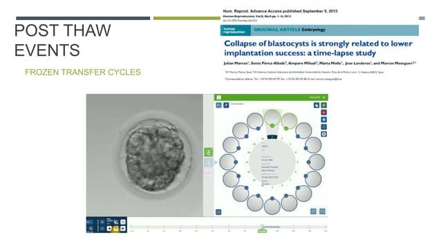 Time lapse embryo monitoring | PPTX