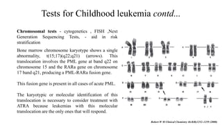 Timeliness in diagnosis of acute leukemia in paediatric age group | PPT