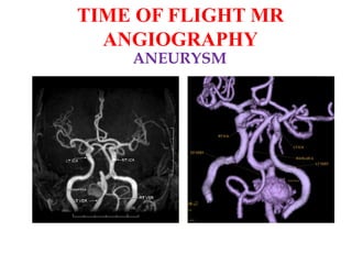 Time of flight mra | PPTX
