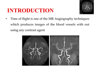 Time of flight mra | PPTX