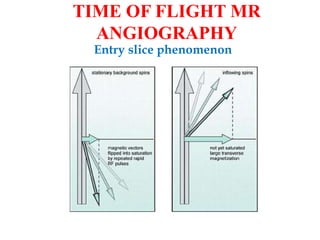 Time of flight mra | PPTX