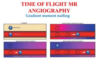 Time of flight mra | PPTX