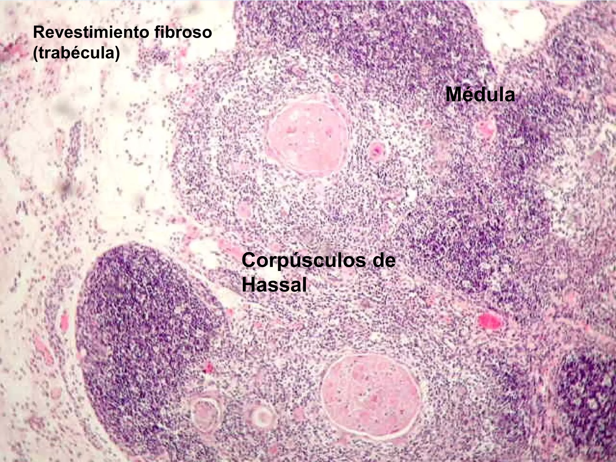 El Timo - Generalidades, Anatomía, Histología, Embriología, Relaciones ...
