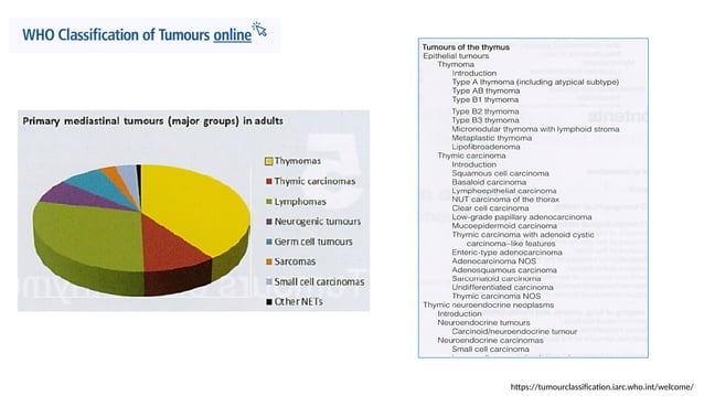 generalidades y tratamiento de cancer de timo | PPTX | Cancer ...