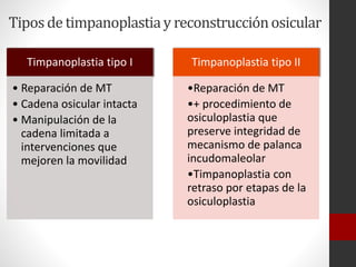 Timpanoplastia | PPTX