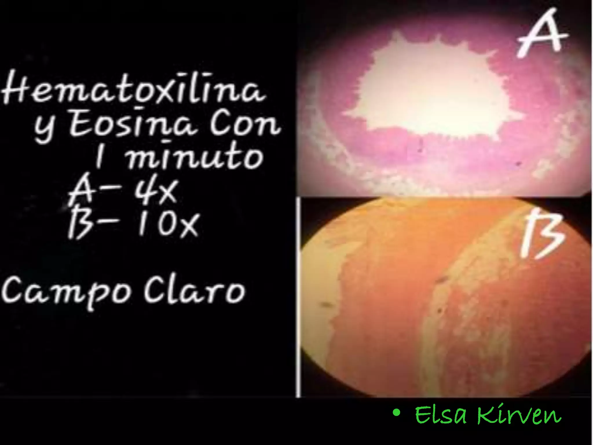 Tinción de Hematoxilina y Eosina | PPT