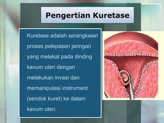 Tindakan operatif pada abortus dengan kuretase kelompok 4 | PPT