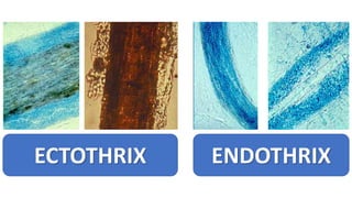 TINEA.pptx | Skin and Dermatology | Diseases and Conditions