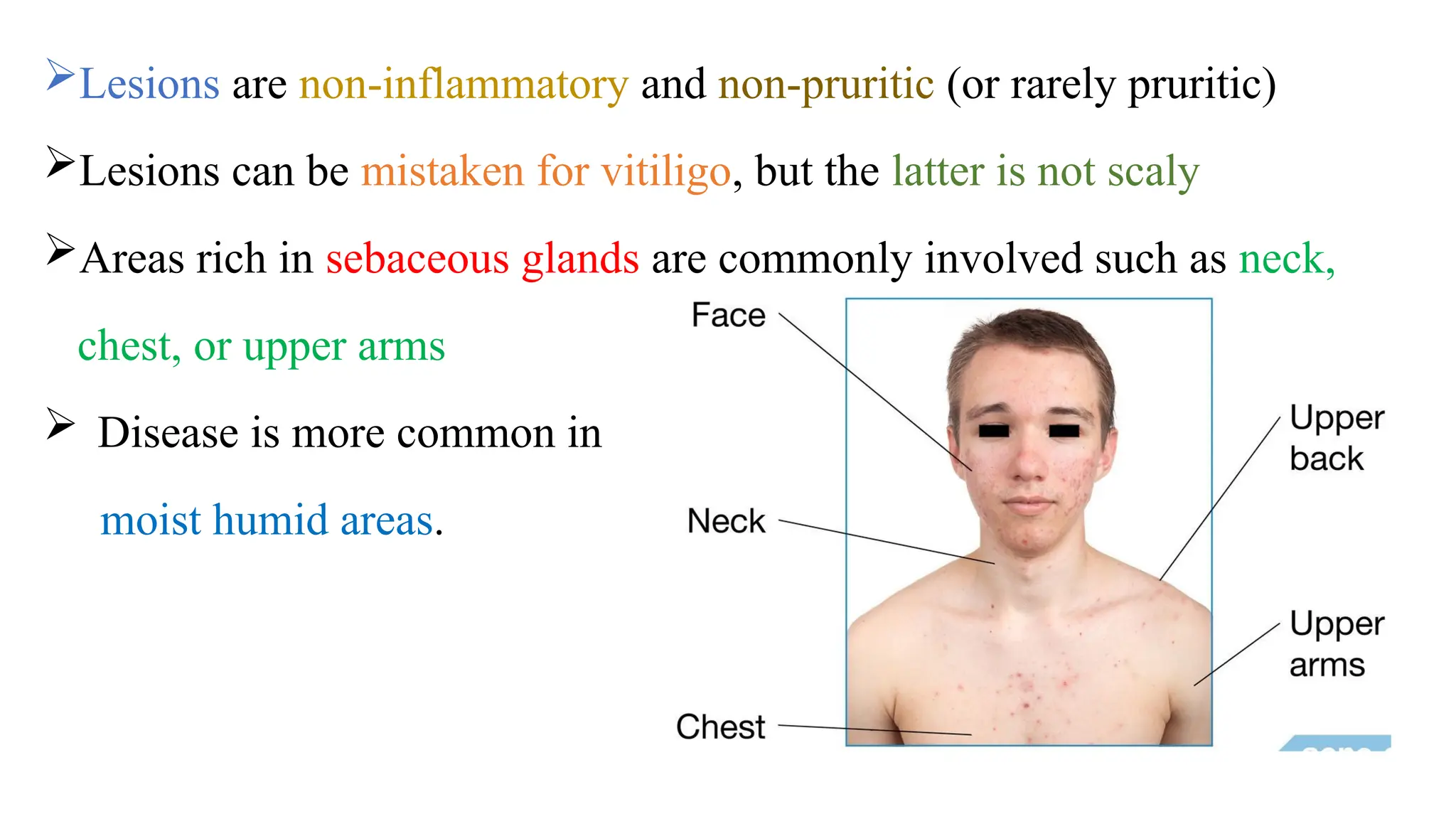 Tinea Versicolor !! Superficial Mycoses !! Fungus !! Clinical ...