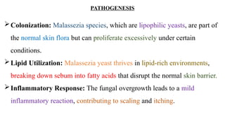Tinea Versicolor !! Superficial Mycoses !! Fungus !! Clinical ...