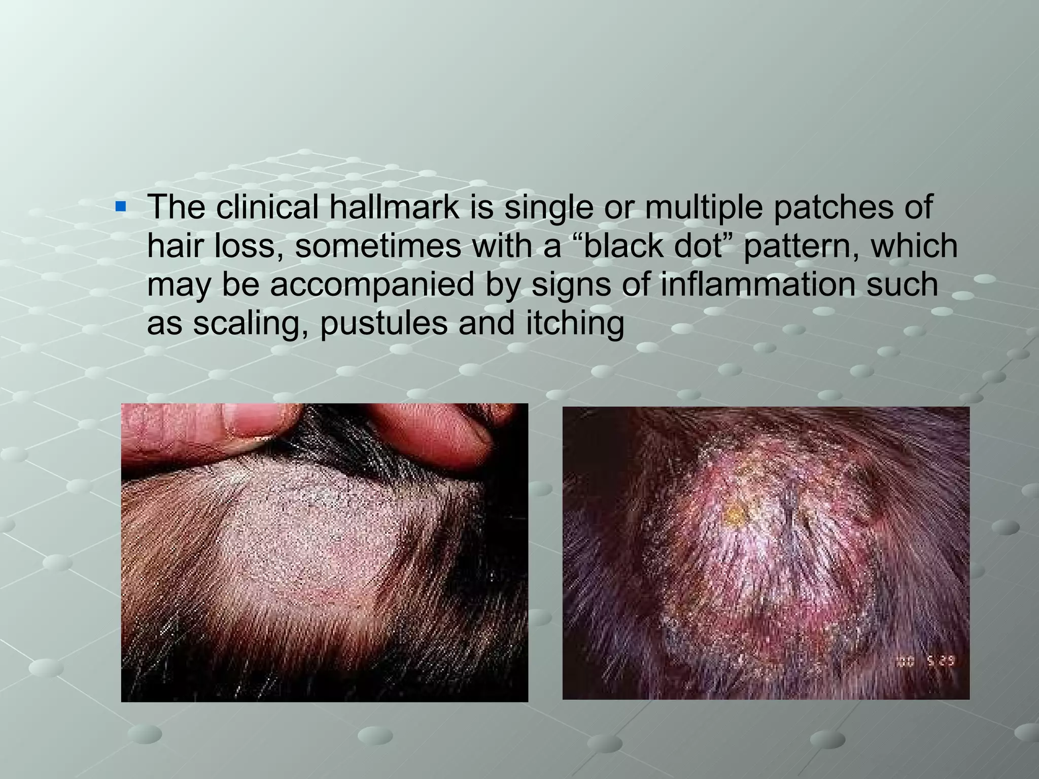 Tinea dermatophytes | PPT