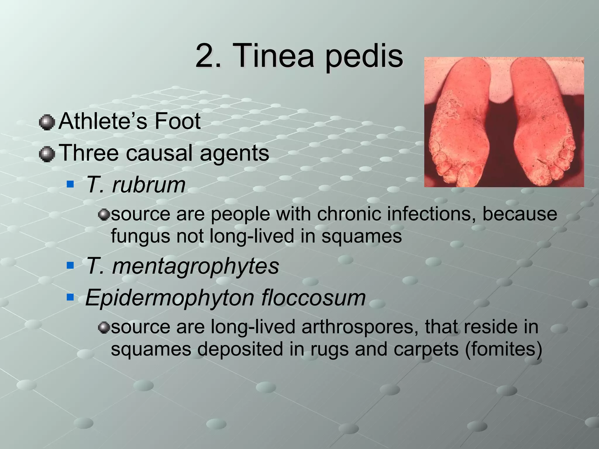 Tinea dermatophytes | PPT