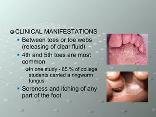 Tinea dermatophytes | PPT