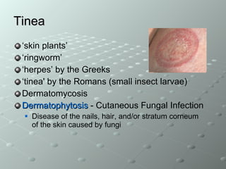 Tinea dermatophytes | PPT