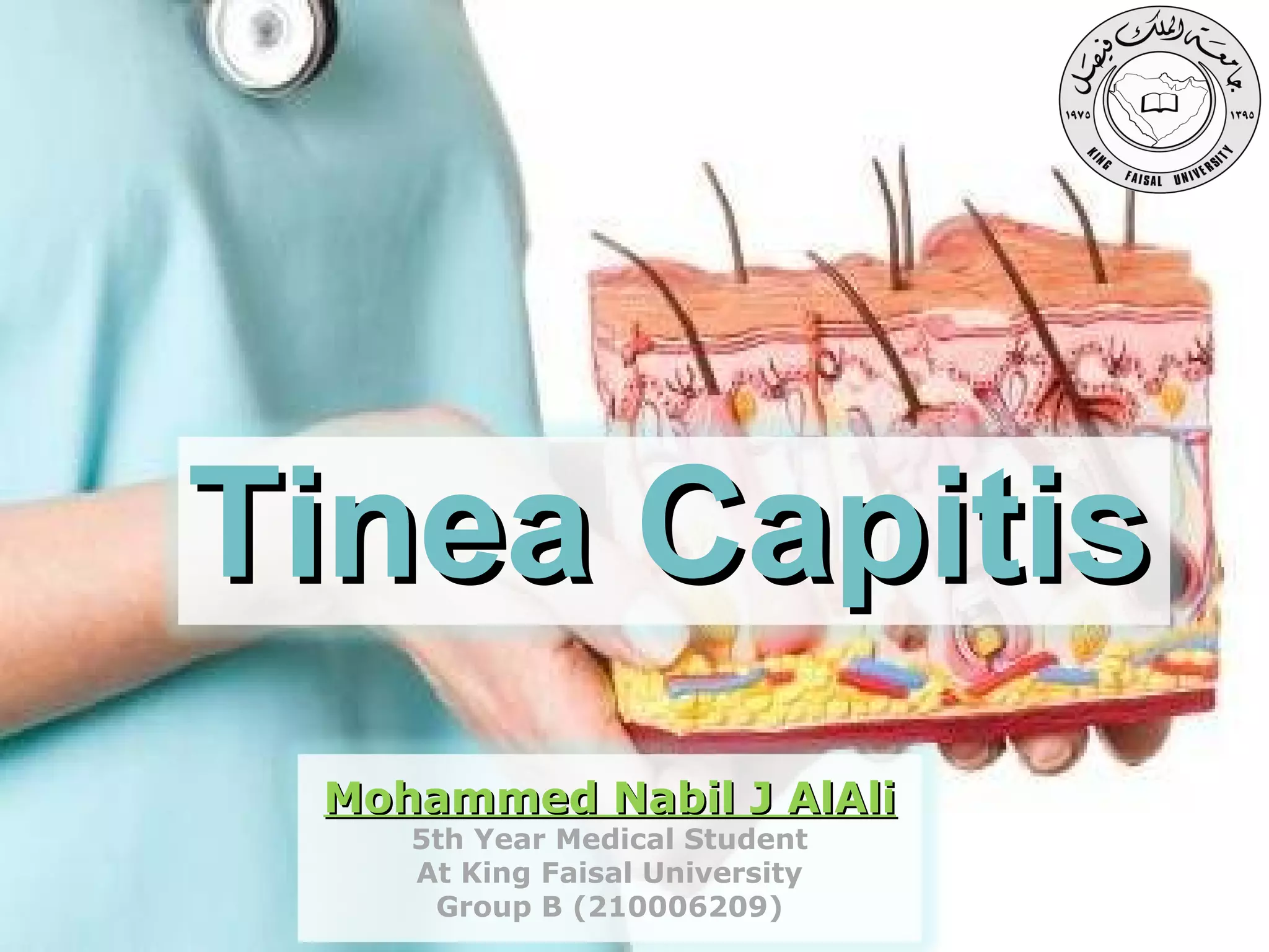Tinea capitis | PPT