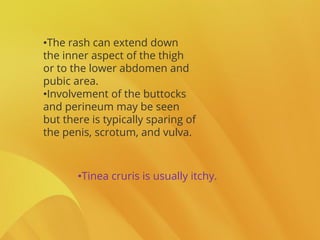 tinea cruris.pdf | Skin and Dermatology | Diseases and Conditions