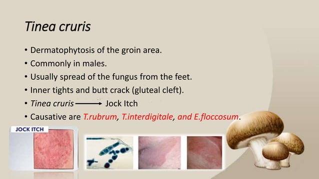 Tinea cruris(Jock itch) | PPSX