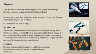 Tinea cruris(Jock itch) | PPSX
