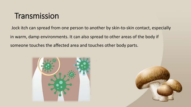 Tinea cruris(Jock itch) | PPSX