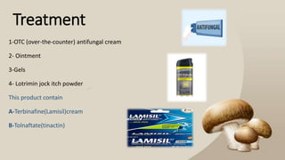 Tinea cruris(Jock itch) | PPSX