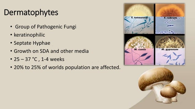 Tinea cruris(Jock itch) | PPSX