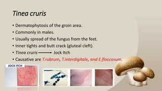 Jock Itch Fungus