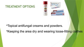 Jock Itch (Tinea Cruris) Jock itch is a contagious fungal infection ...