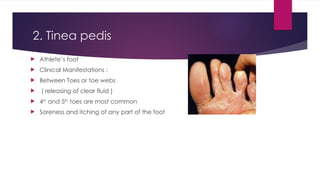 Different types of Tinea infections ppt medicine.pptx