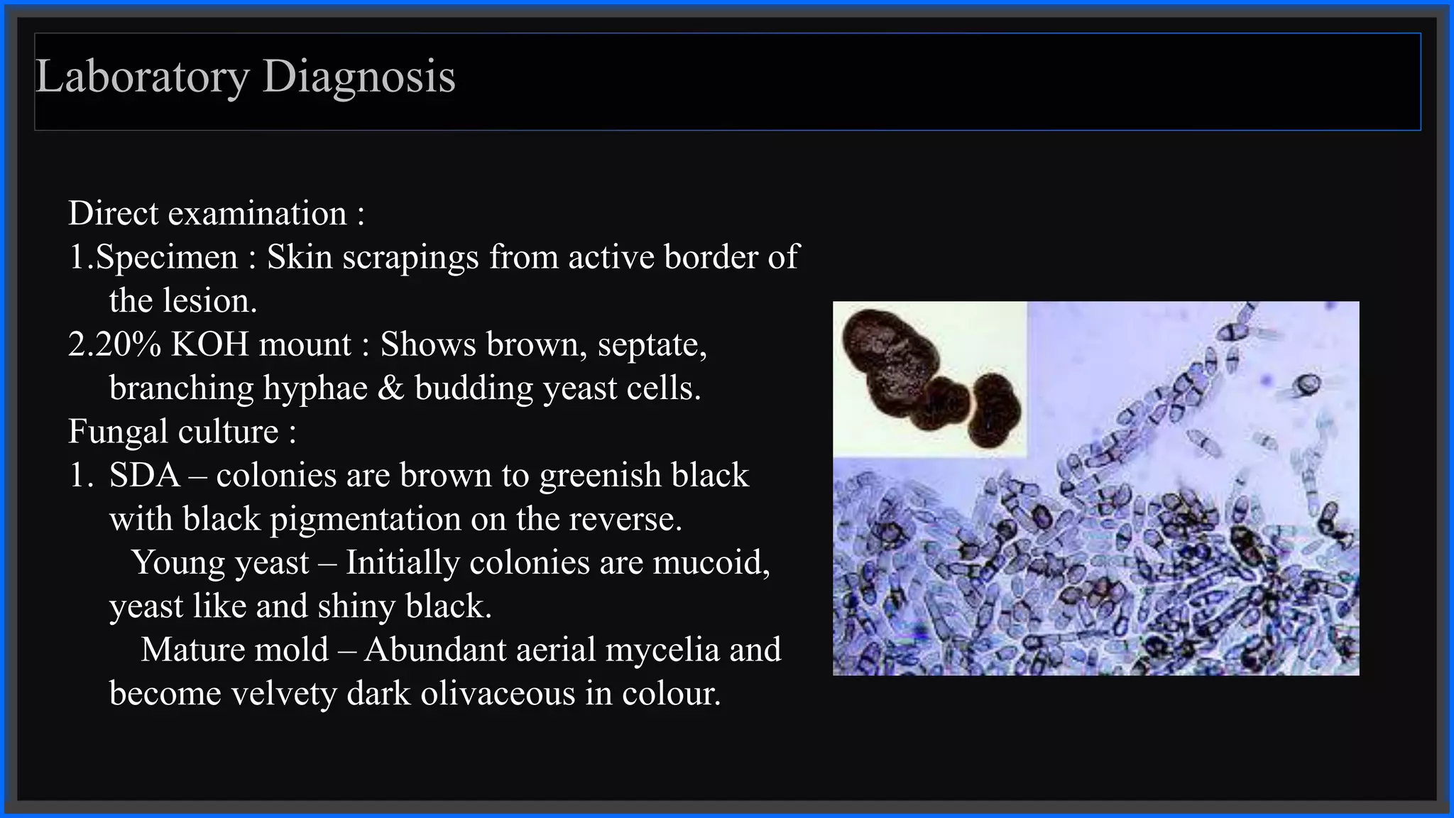 Tinea nigra presentation | PPTX